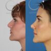 【18 Types of Noses: What They Are and Differences 2025】
