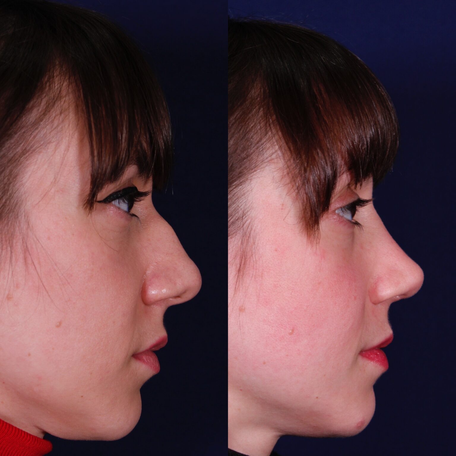 【18 Types of Noses: What They Are and Differences 2025】