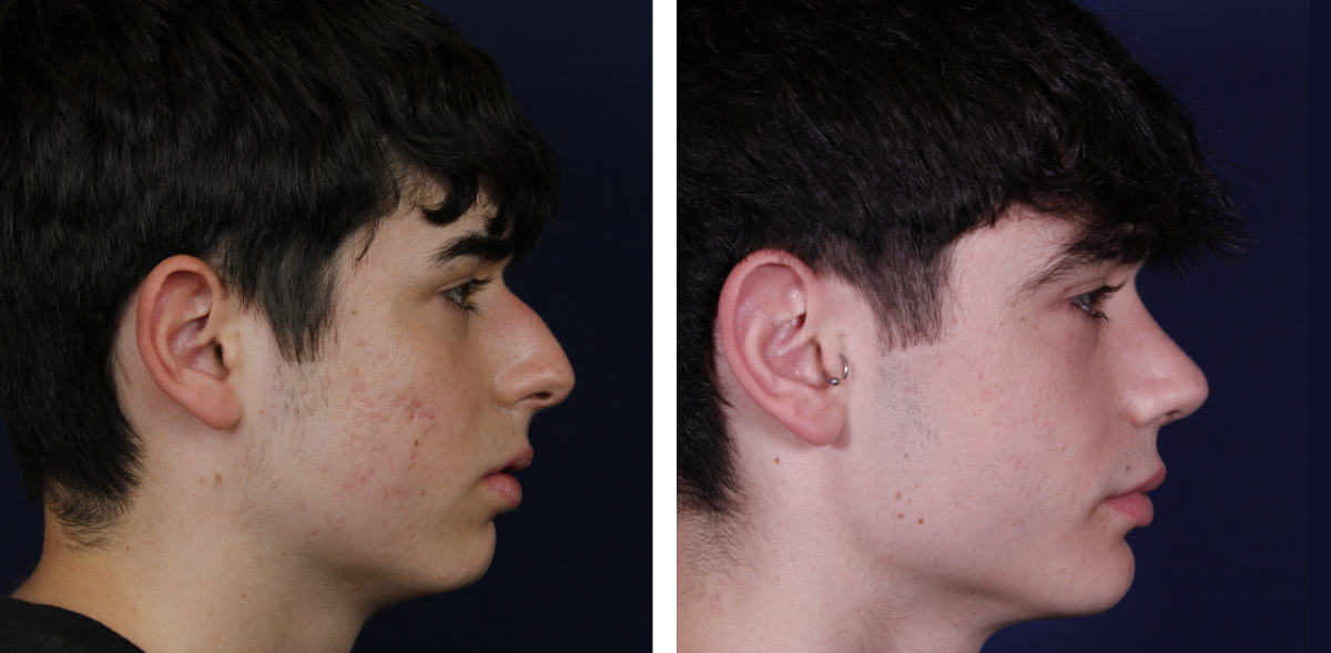 18 types de nez : ce qu'ils sont et leurs différences (2025)